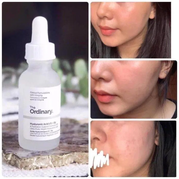 Review The Ordinary Hyaluronic Acid 2% + B5 Serum có tốt không ...