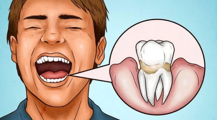 4 dấu hiệu cho thấy bạn đang đánh răng quá mạnh và cách khắc phục để ...